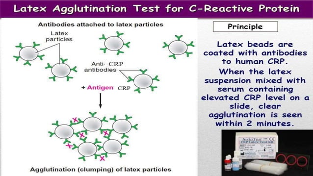 Acute phase proteins | PPTX