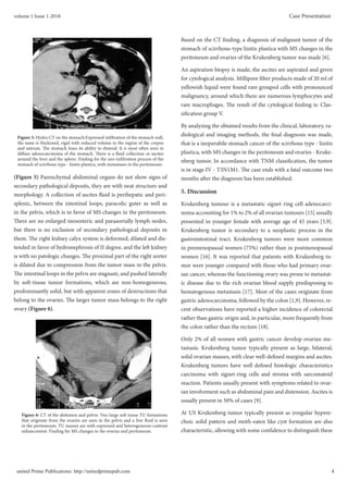 Appearance_of_Krukenberg_Tumor_from_Gast.pdf