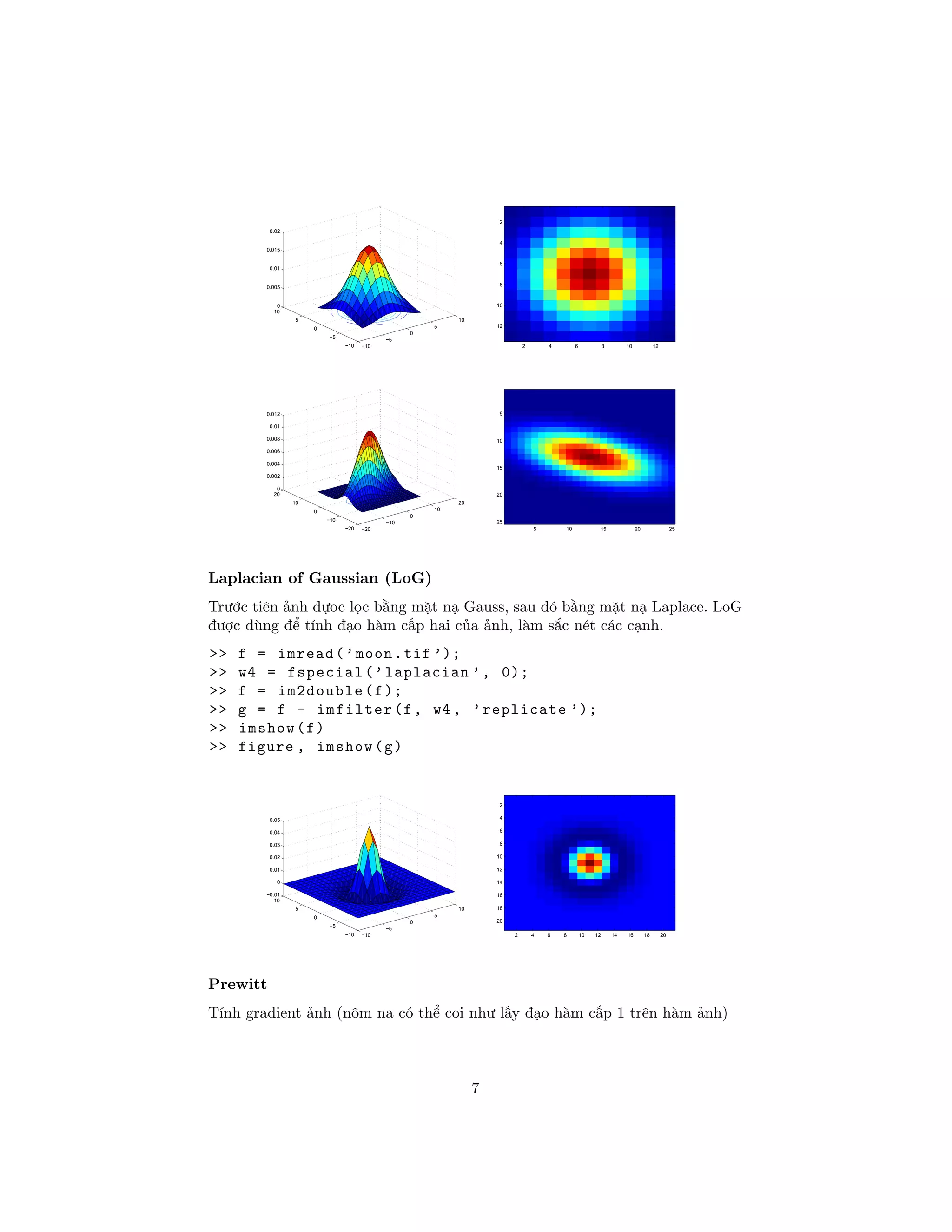 Digital Image Processing with Matlab | PDF