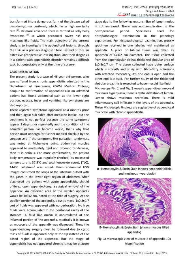 Appendiceal_Mucocele_Chronic_Appendicitis.pdf