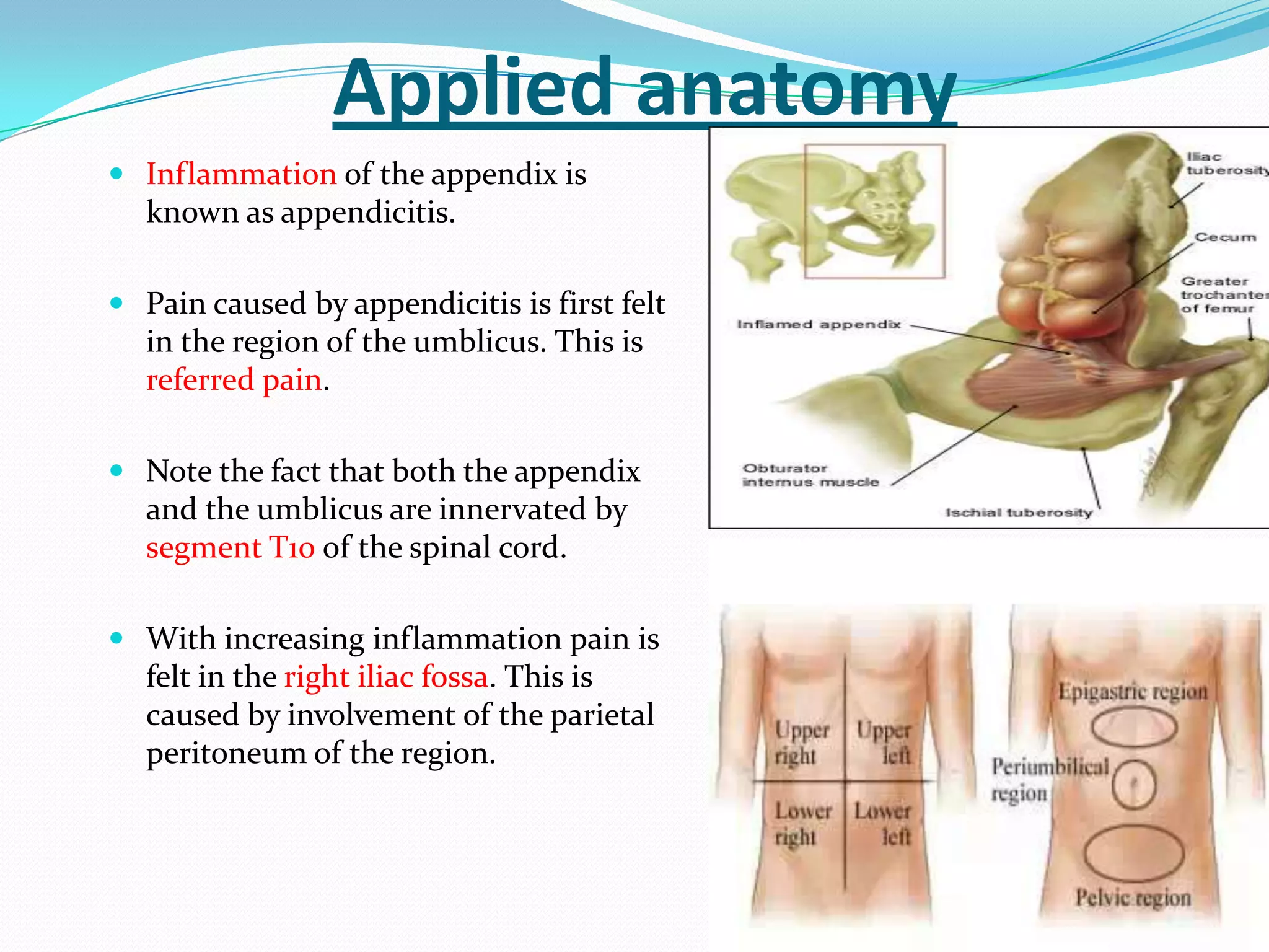 Appendicectomy | PPTX