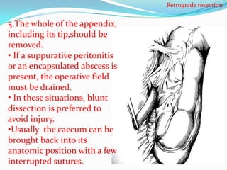 Appendicectomy | PPTX