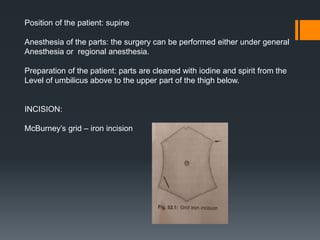 Appendicectomy | PPTX
