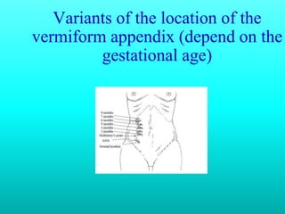 appendicite.pptx