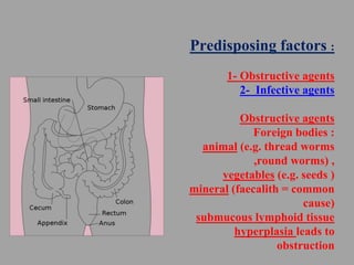 appendicite4 — копия.pptx