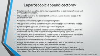 Appendicitis | PPT