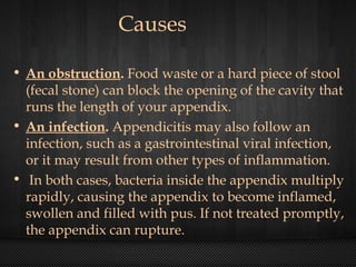 Appendicitis | PPT