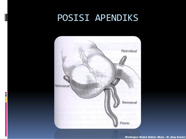 Appendicitis