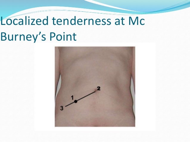 Appendicitis PPT By Dr Anil Kumar, Assist Professor,Gen Surgery, AIIM…