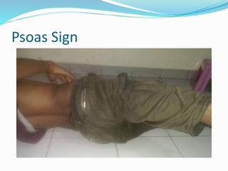 Appendicitis PPT By Dr Anil Kumar,Assist Prof( Gen Surgery) AIIMS ...