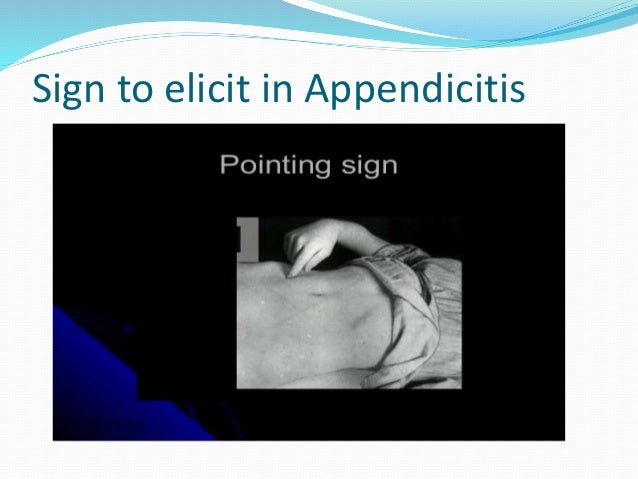 Appendicitis PPT By Dr Anil Kumar,Assist Prof( Gen Surgery) AIIMS, Pa…