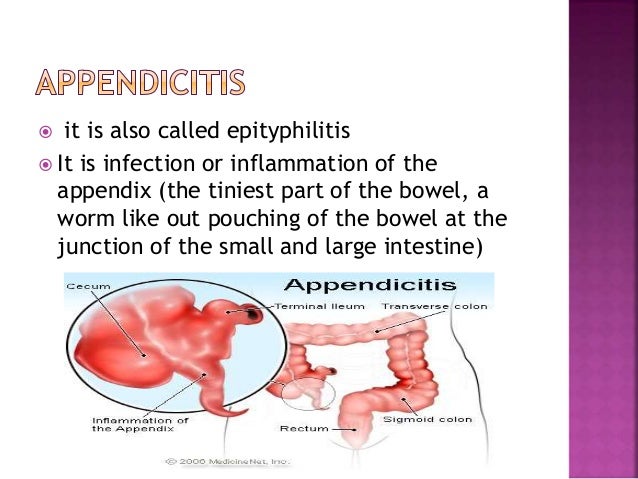 Appendicitis