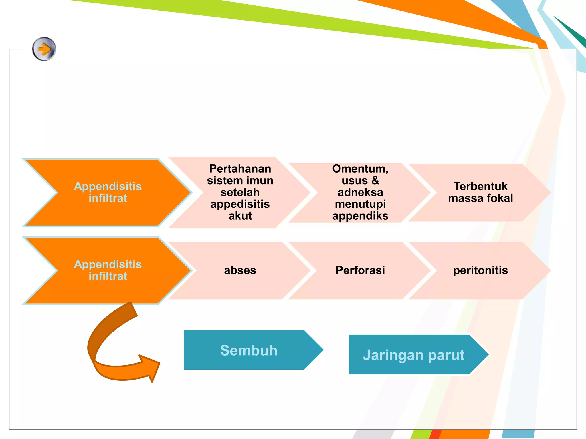 Appendicitis) | PPTX