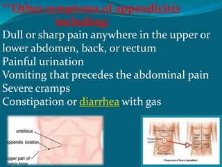 Appendicitis | PPTX