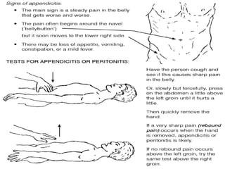 Appendicitis | PPTX