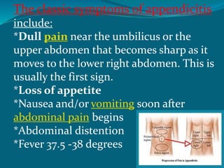 Rebound Tenderness Appendicitis
