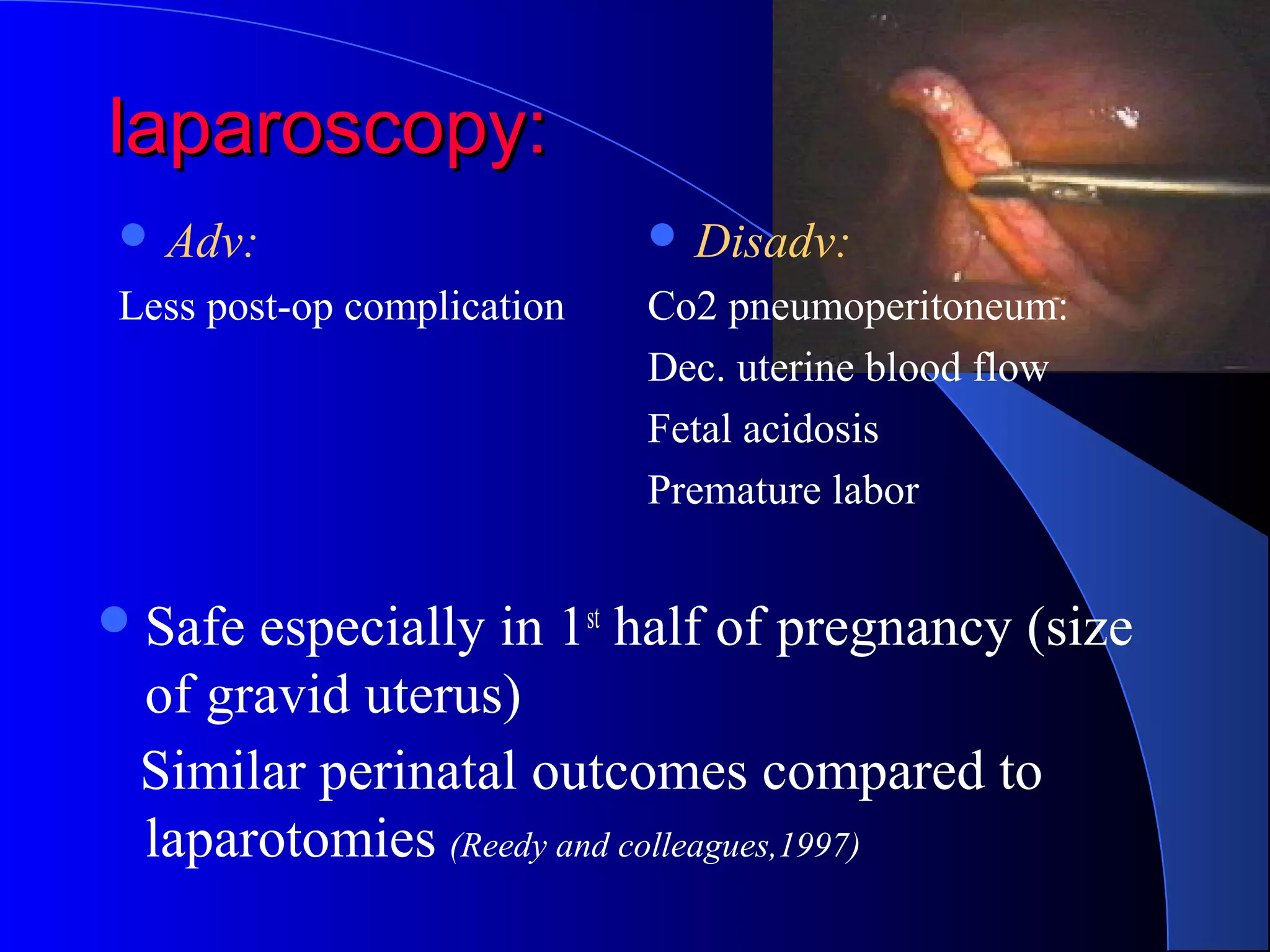 appendicitis-ppt
