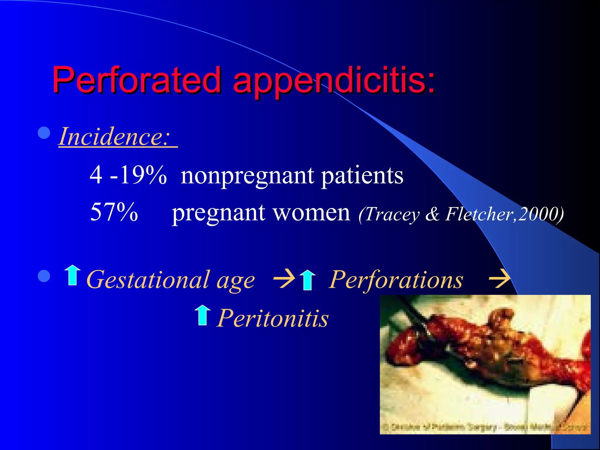 Appendicitis | PPT