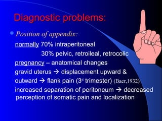 Appendicitis | PPT