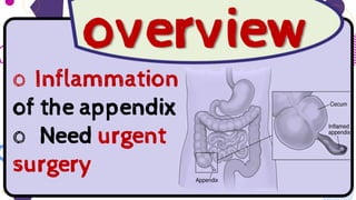Appendicitis | PPT