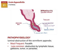 Appendicitis | PPT