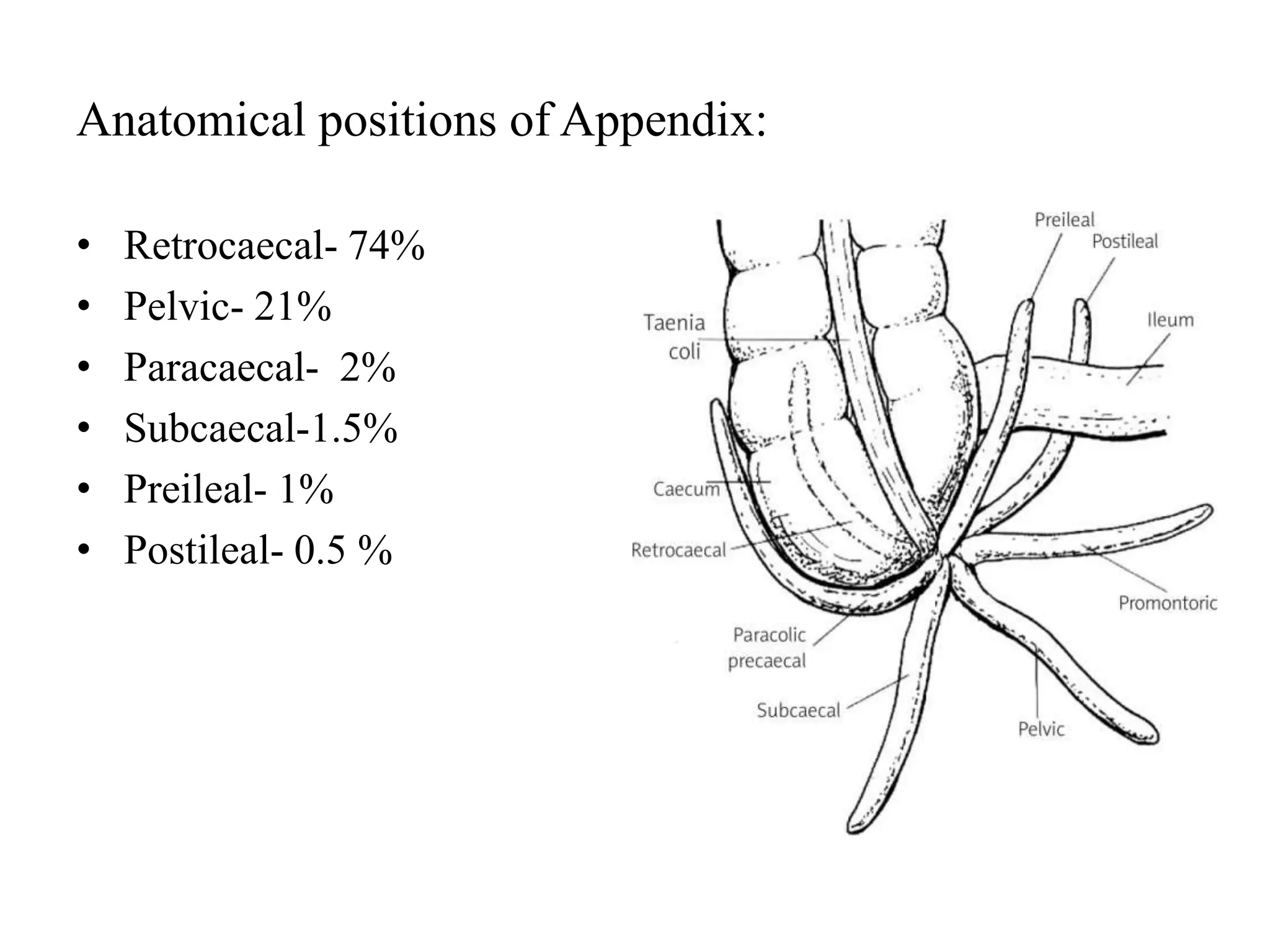 Appendicitis | PPT