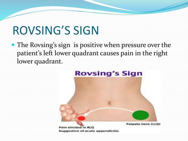 Appendicitis | PPTX | Digestive Disorders | Diseases and Conditions