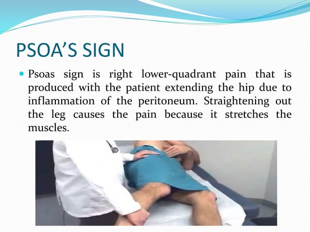 Appendicitis | PPTX | Digestive Disorders | Diseases and Conditions