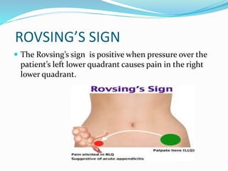 Rovsing Sign