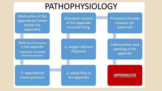 Appendicitis | PPTX