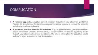 Appendicitis | PPTX