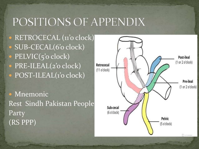 Appendicitis | PPT