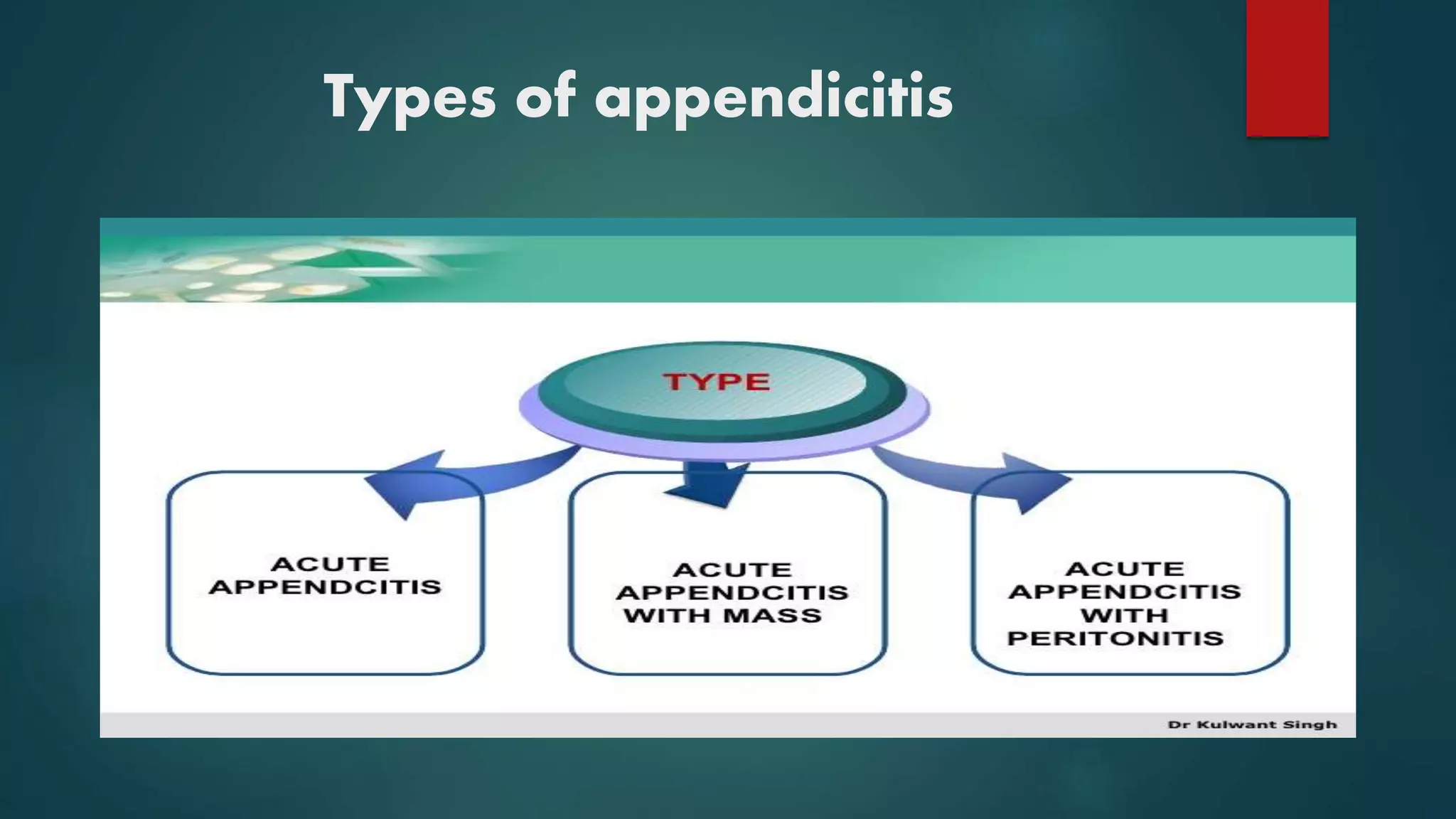 Appendicitis | PPTX