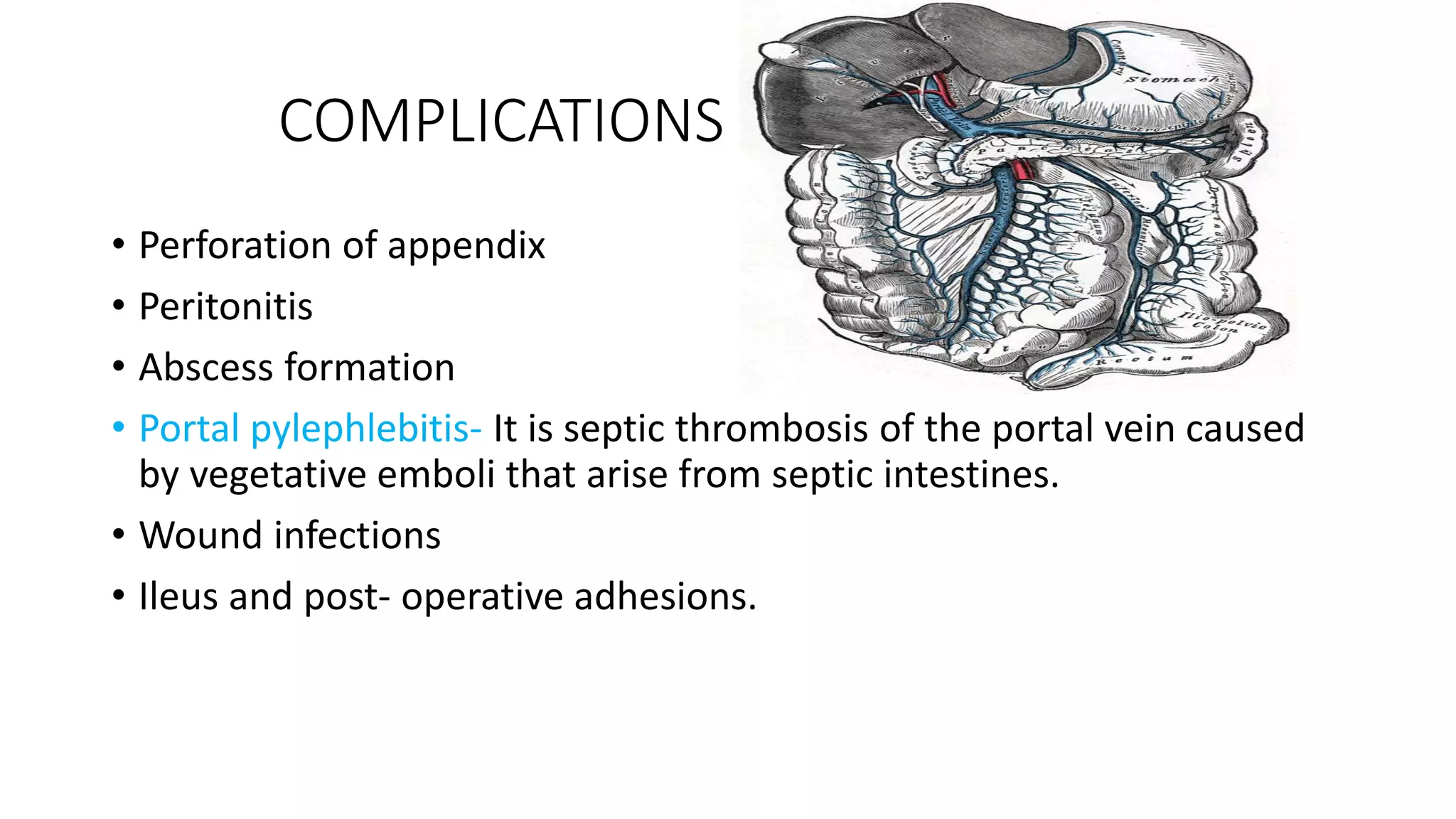 Appendicitis | PDF