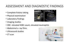 Appendicitis | PDF