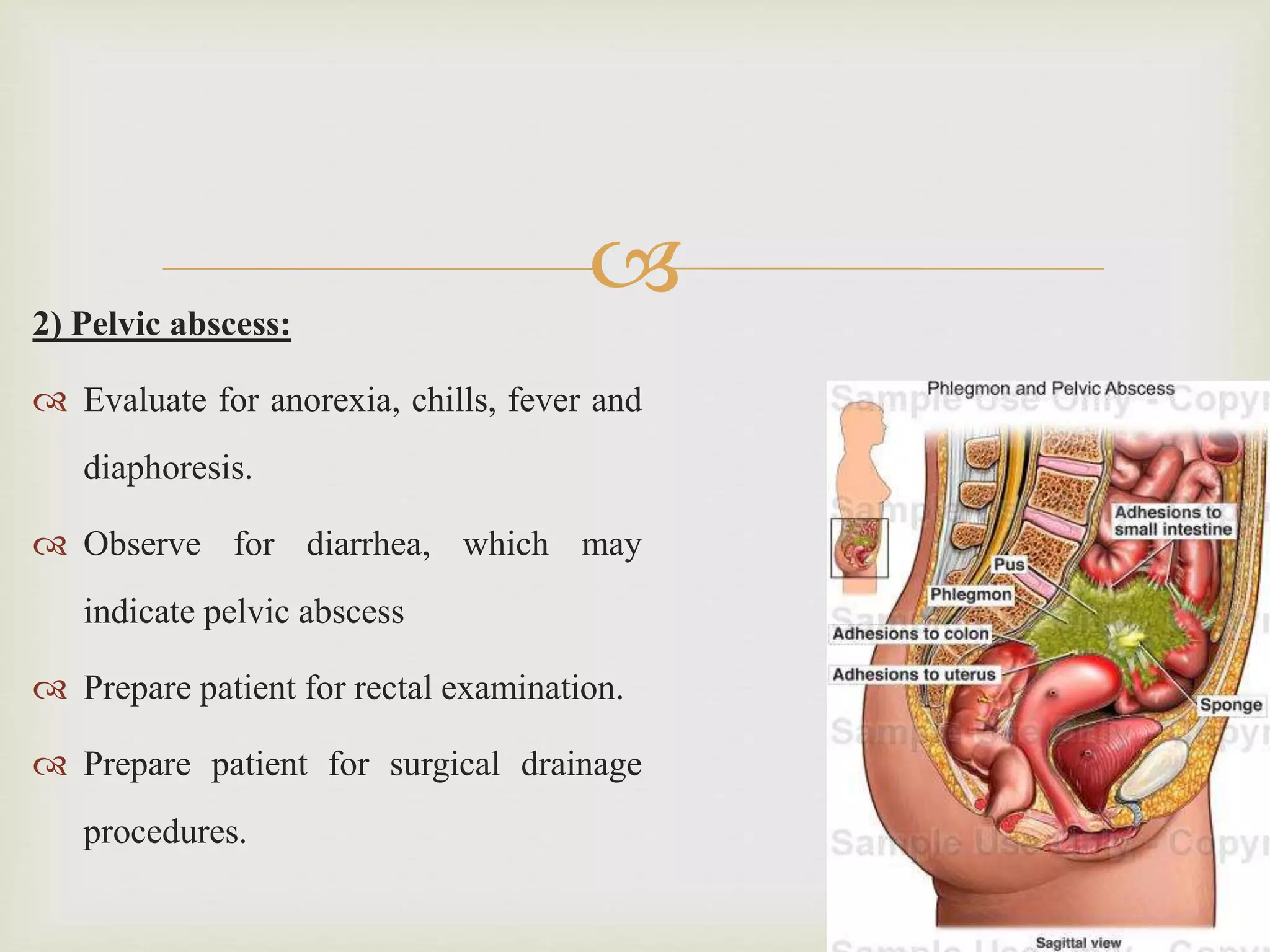 Appendicitis | PPTX