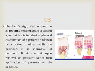 Appendicitis | PPT