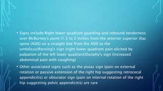 APPENDICITIS | PPT