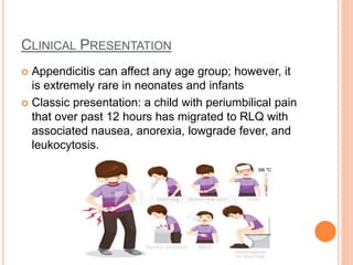 Appendicitis.pptx