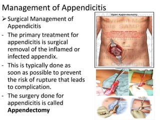 Appendicitis.pptx | Digestive Disorders | Diseases and Conditions