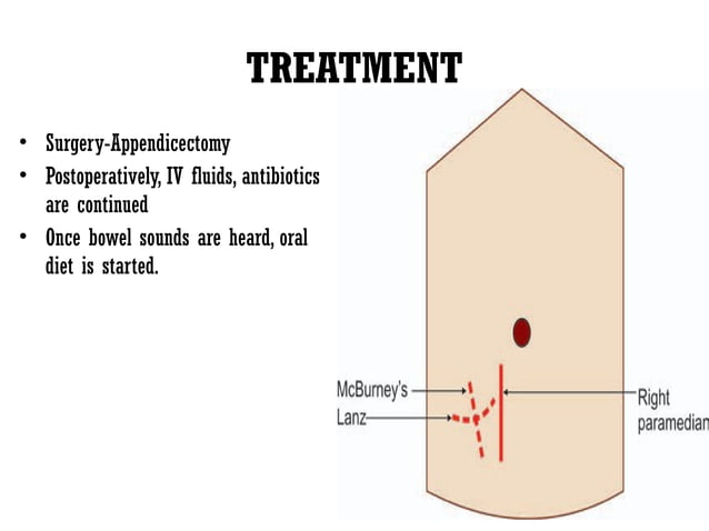 Acute appendicitis, diagnosis and management.pptx