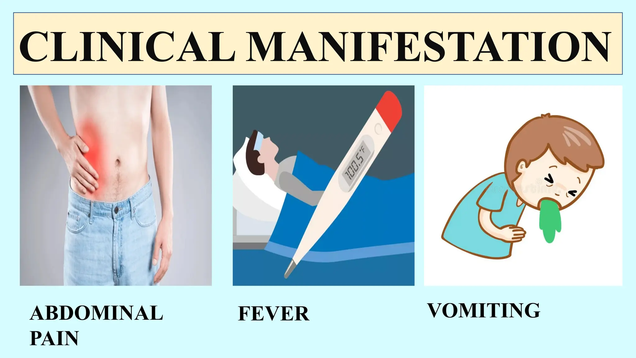 Powerpoint presentation on APPENDICITIS Appendicitis is a medical ...