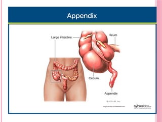 Nursing management for appendicitis.pptx