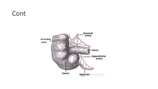 APPENDICITIS power point presentation.pptx