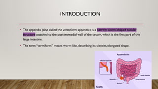 Appendicitis is inflammation of appendix .pptx