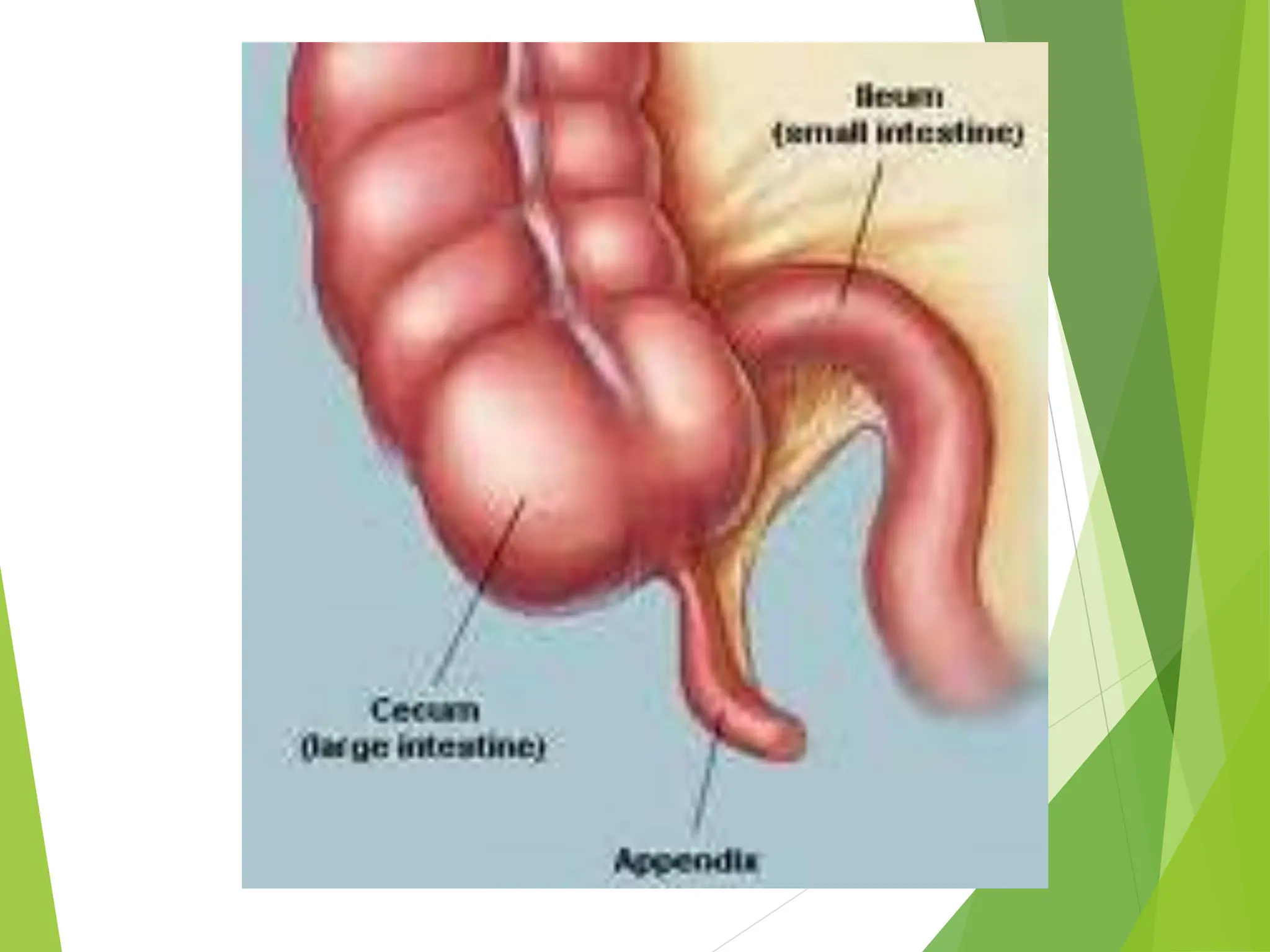 full APPENDICITIS lecture-ANDREW NJAMBA .pptx