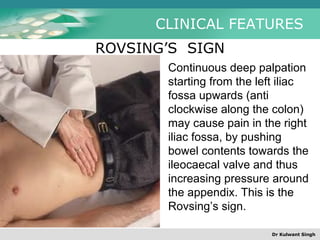 A P P E N D I C I T I S | PPT