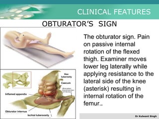 A P P E N D I C I T I S | PPT