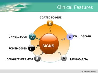 A P P E N D I C I T I S | PPT