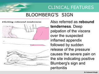 A P P E N D I C I T I S | PPT